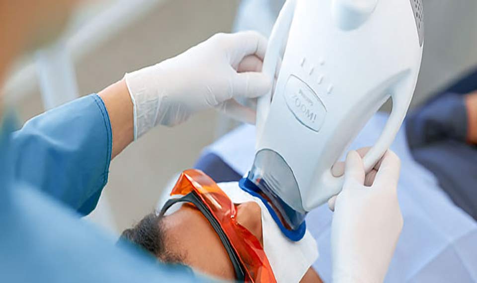 SmilePerfectors Offers Advanced Teeth Whitening Using the Zoom ...