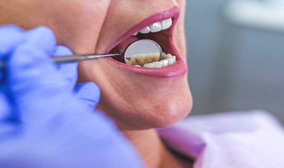 Want to Save your Infected, Decayed and Injured Teeth? Contact an ...