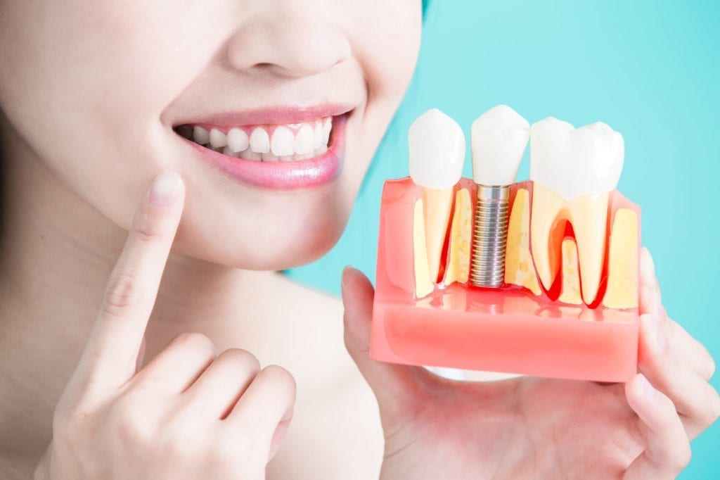 Here are 7 Symptoms and Signs of Dental Problems - Smile Perfectors